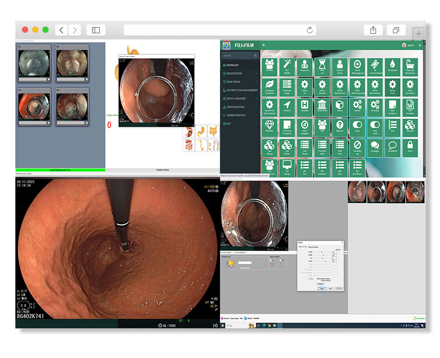 ENDOCAM - Endoscopy Documentation System